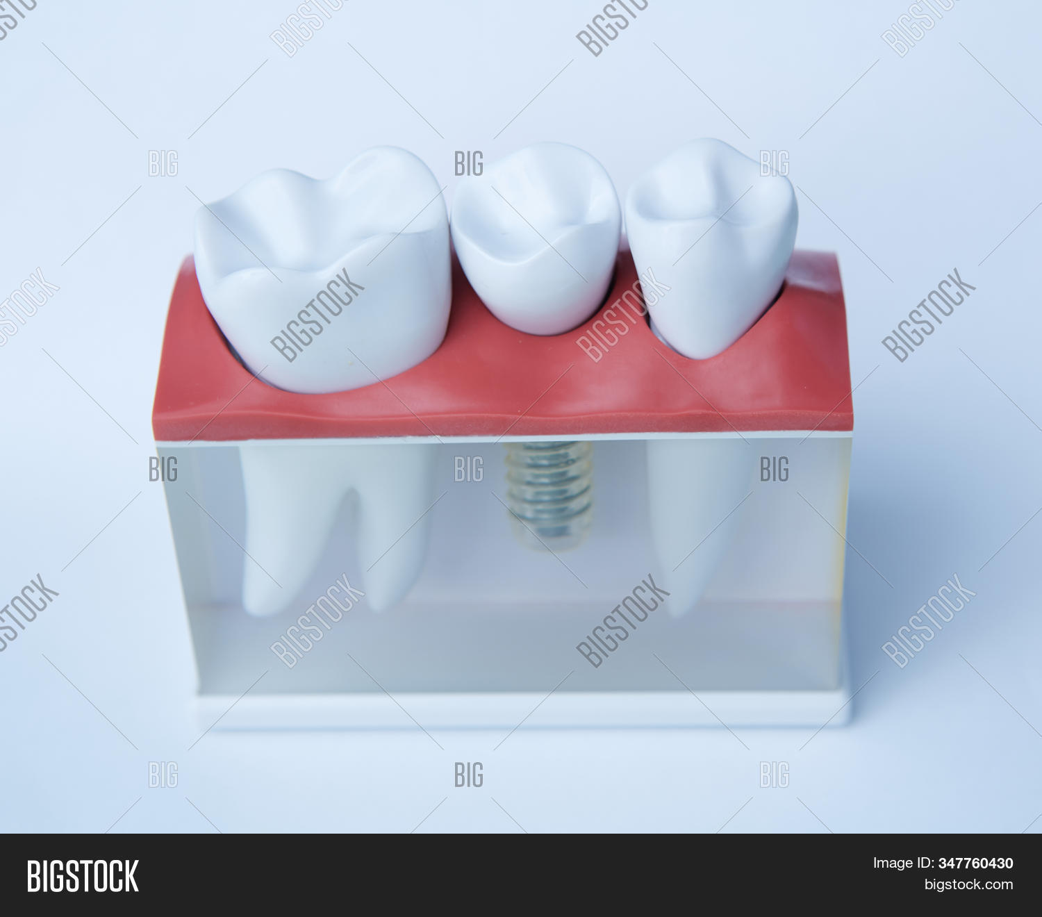 Dentists Tooth Plastic Image & Photo (Free Trial) | Bigstock