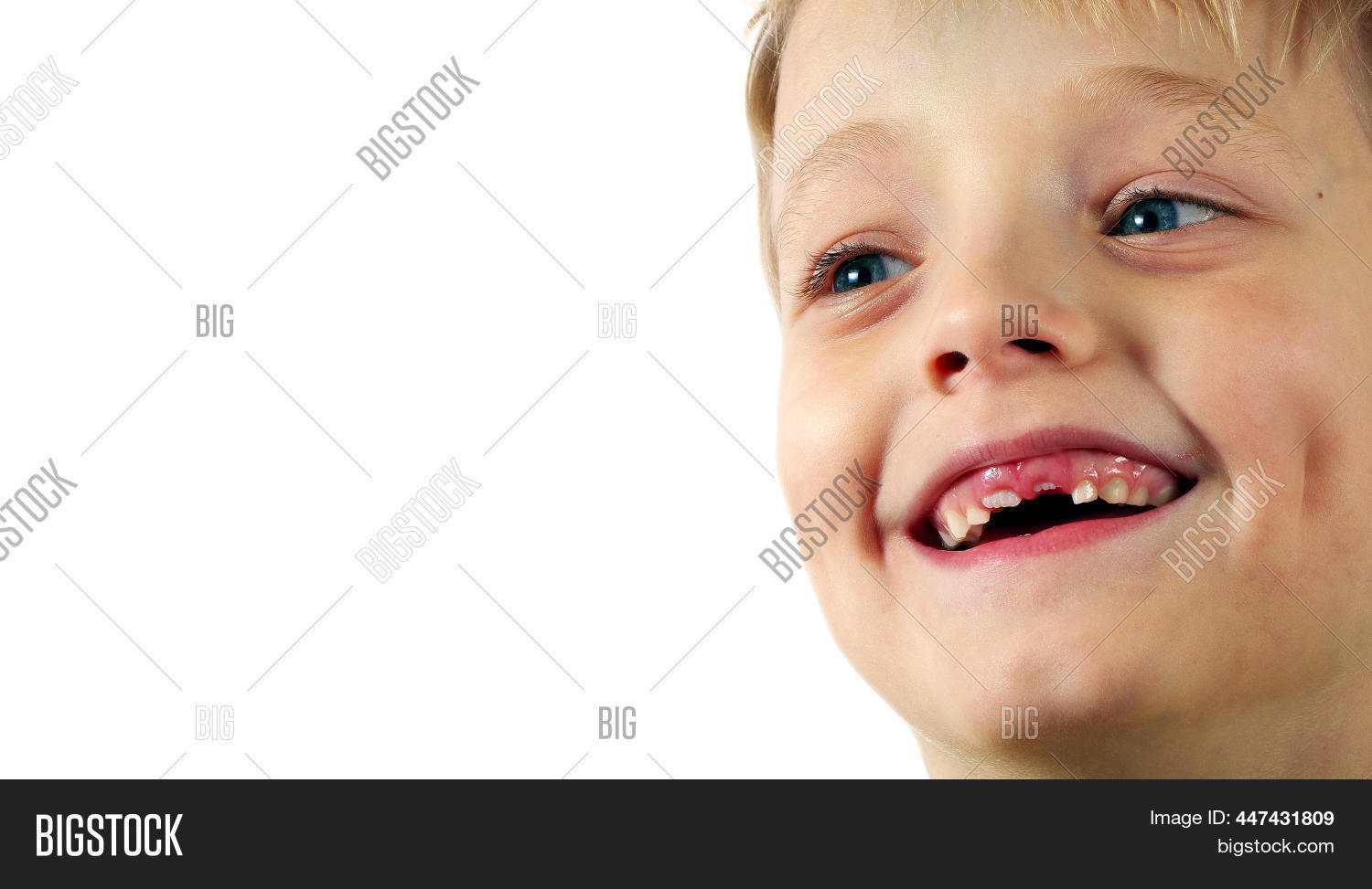 Child Missing Teeth. Image & Photo (Free Trial) | Bigstock