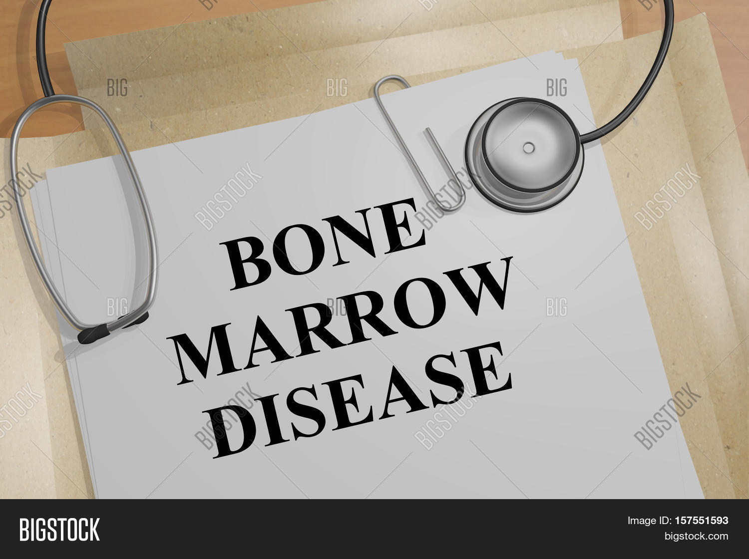 Bone Marrow Disease - Image & Photo (Free Trial) | Bigstock