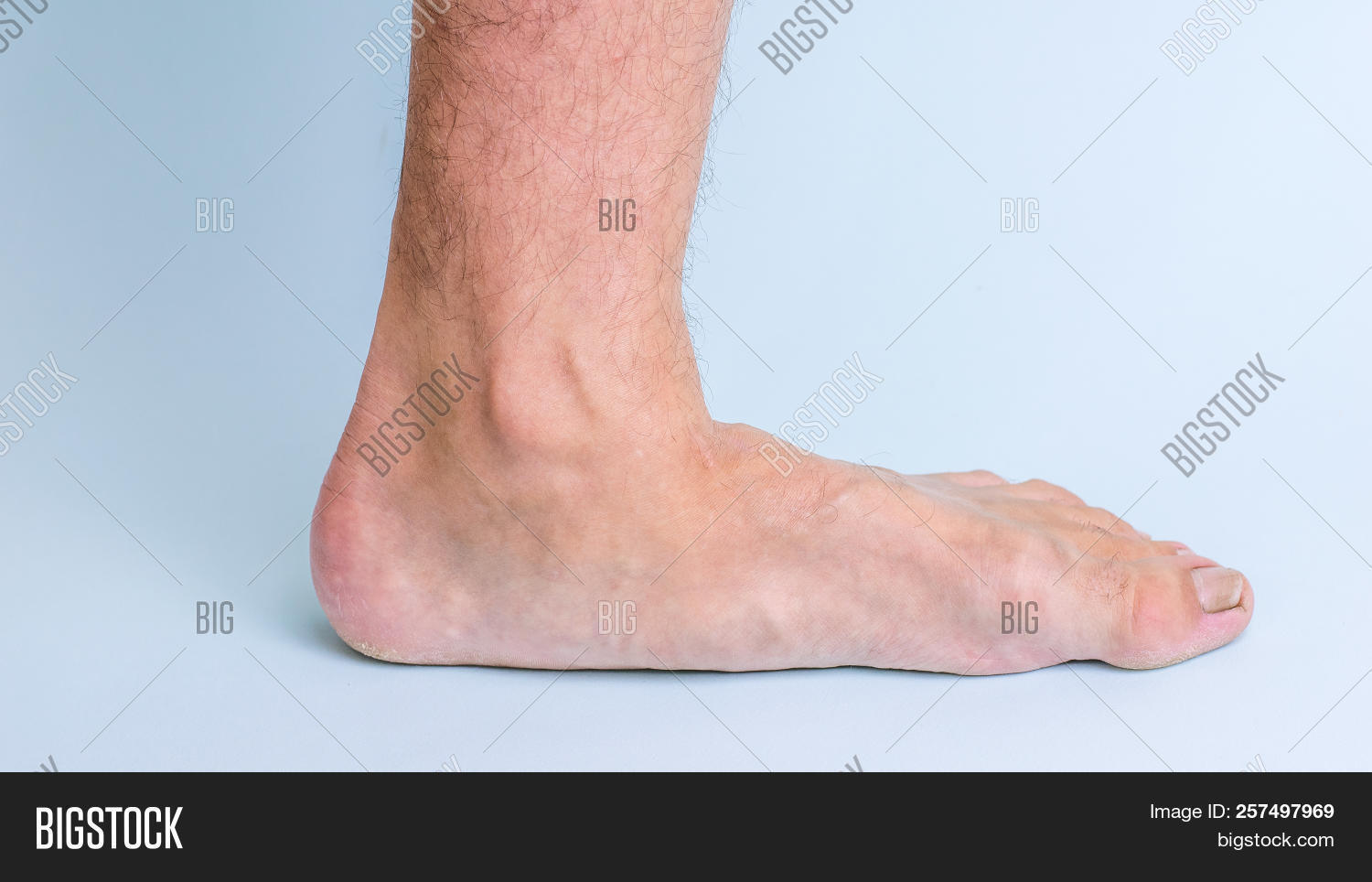 Left Leg Man Signs Image & Photo (Free Trial) | Bigstock