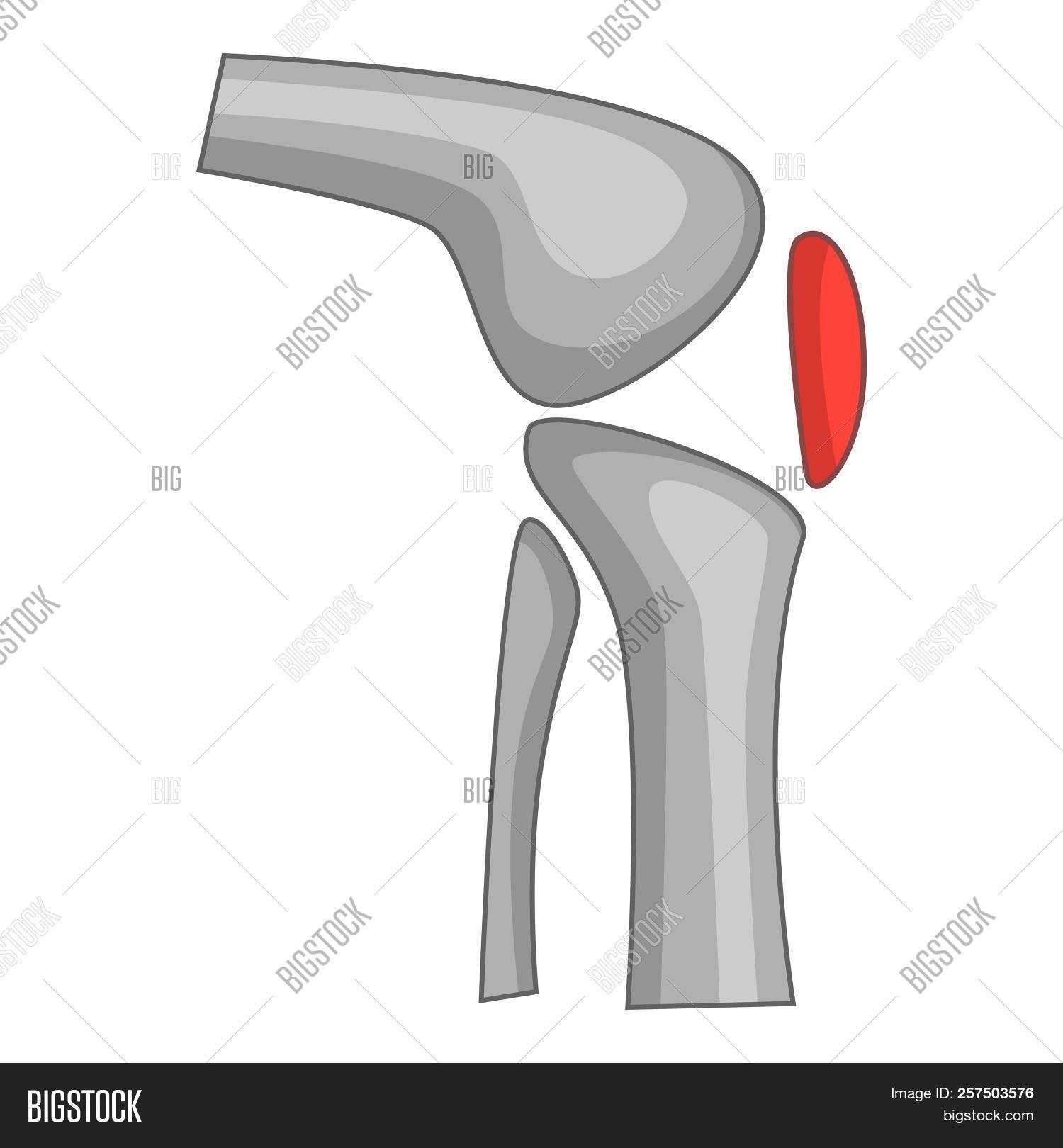 Knee Replacement Image & Photo (Free Trial) | Bigstock