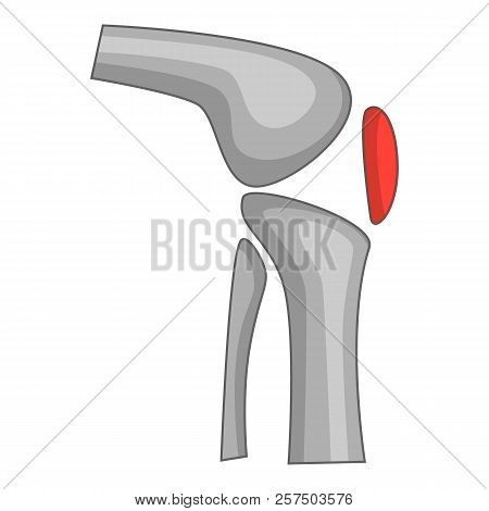 Knee Replacement Image & Photo (Free Trial) | Bigstock