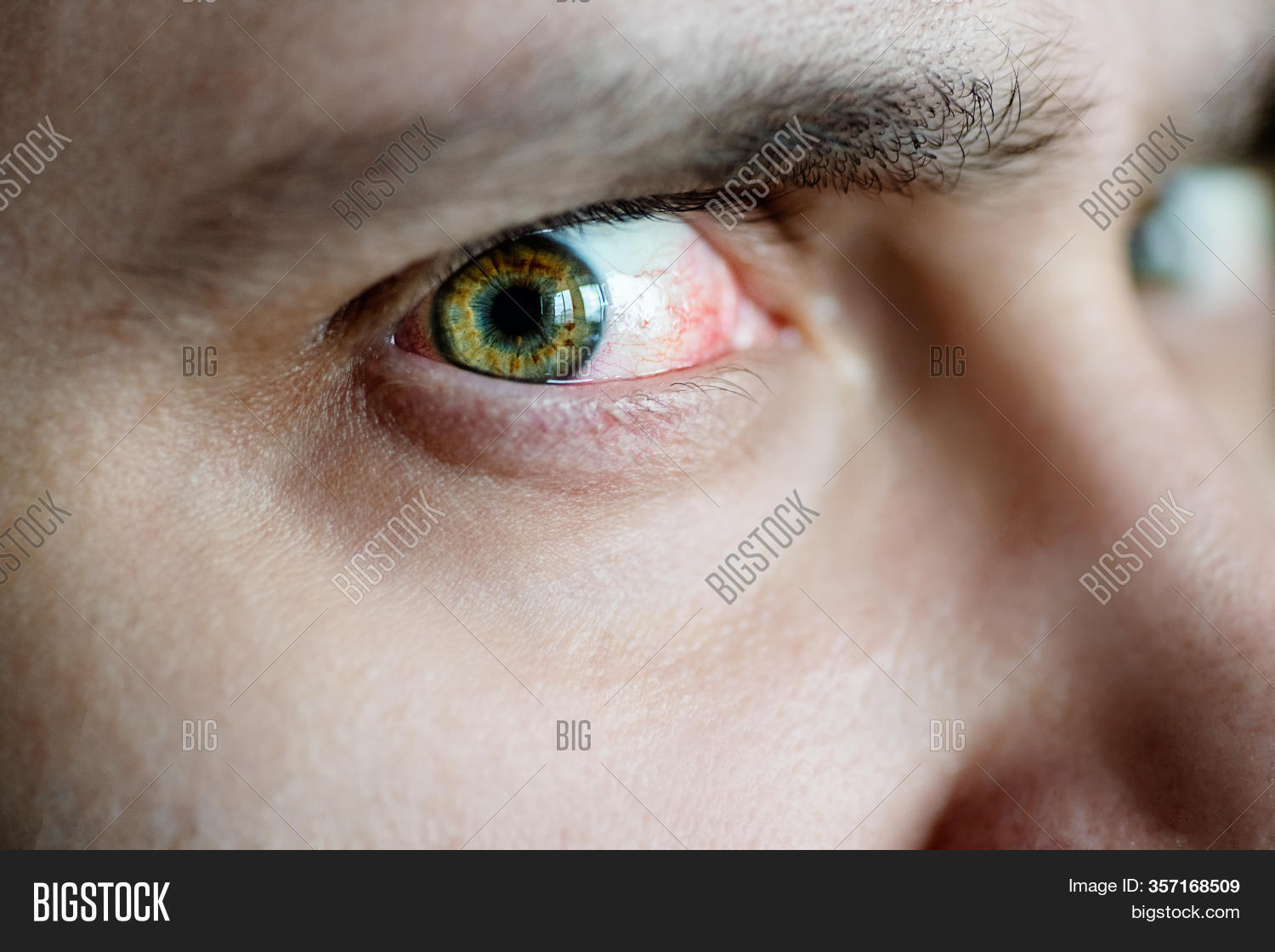 Closeup Red Eye Image & Photo (Free Trial) | Bigstock
