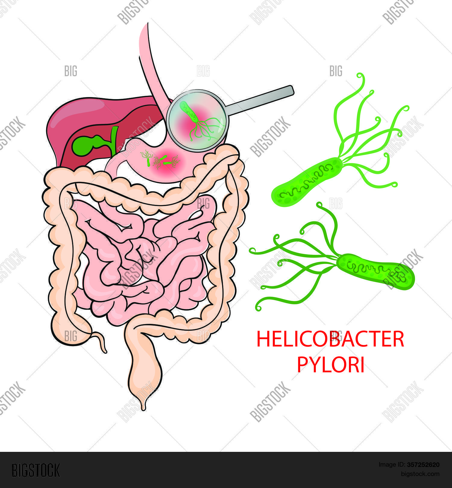 Helicobacter Pylori Vector & Photo (Free Trial) | Bigstock