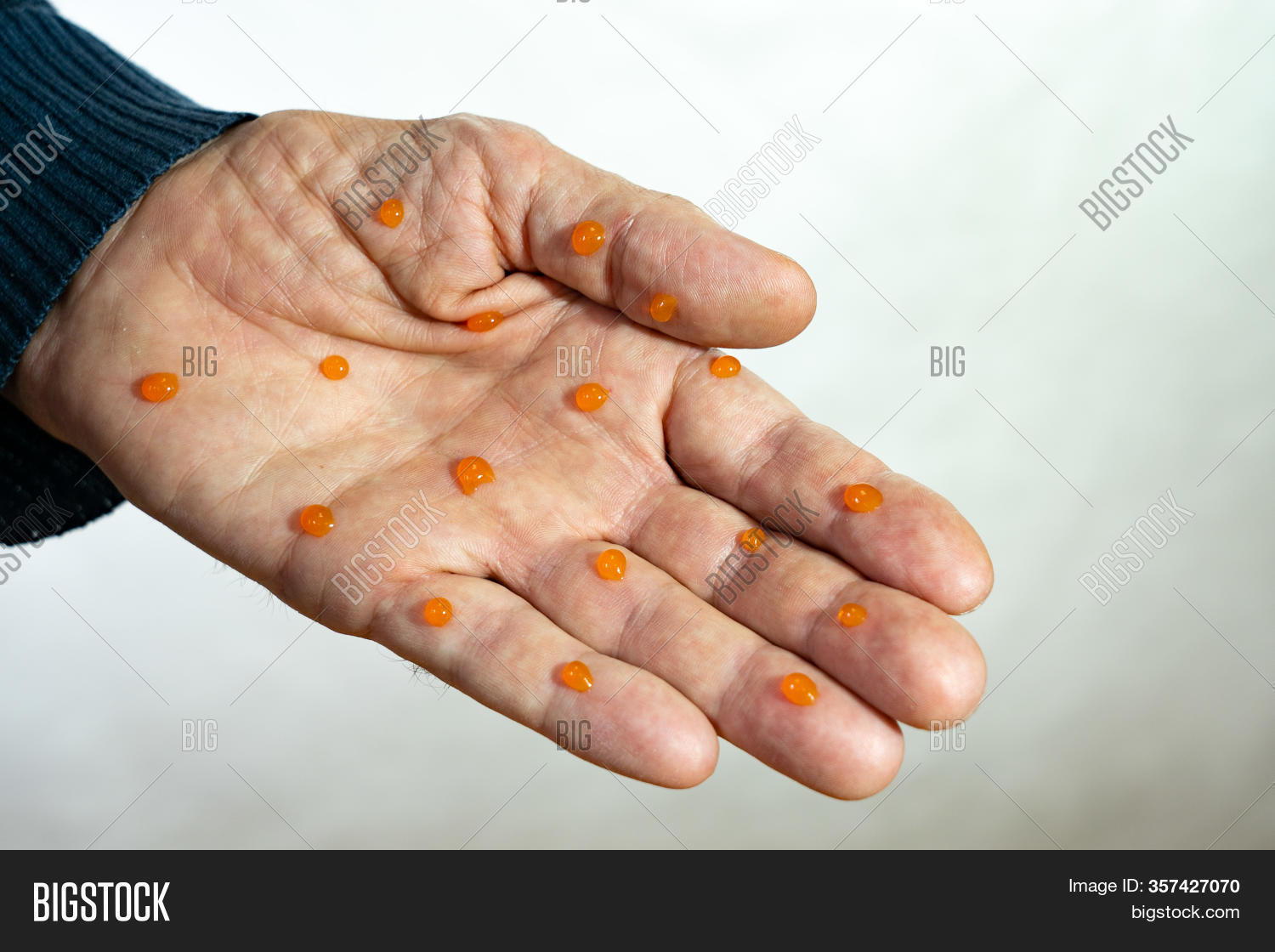 Viral Infection Image & Photo (Free Trial) | Bigstock