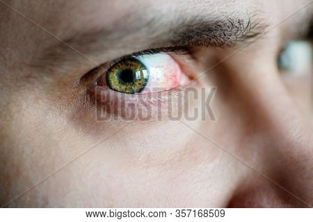 Closeup Red Eye Image & Photo (Free Trial) | Bigstock