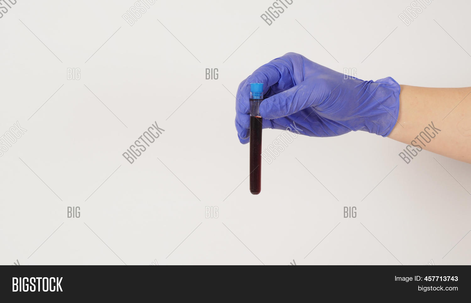 Hand Holding Blood Image & Photo (Free Trial) | Bigstock