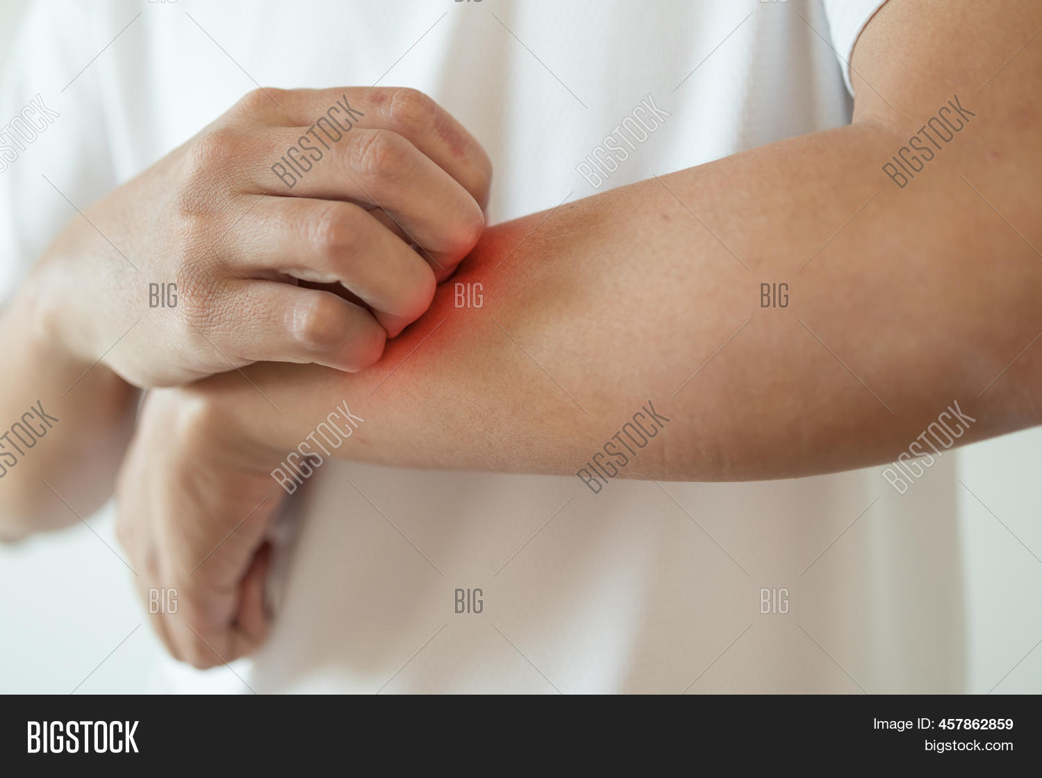 Man Itching Scratching Image & Photo (Free Trial) | Bigstock