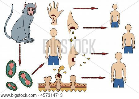 Monkeypox. Route Vector & Photo (Free Trial) | Bigstock