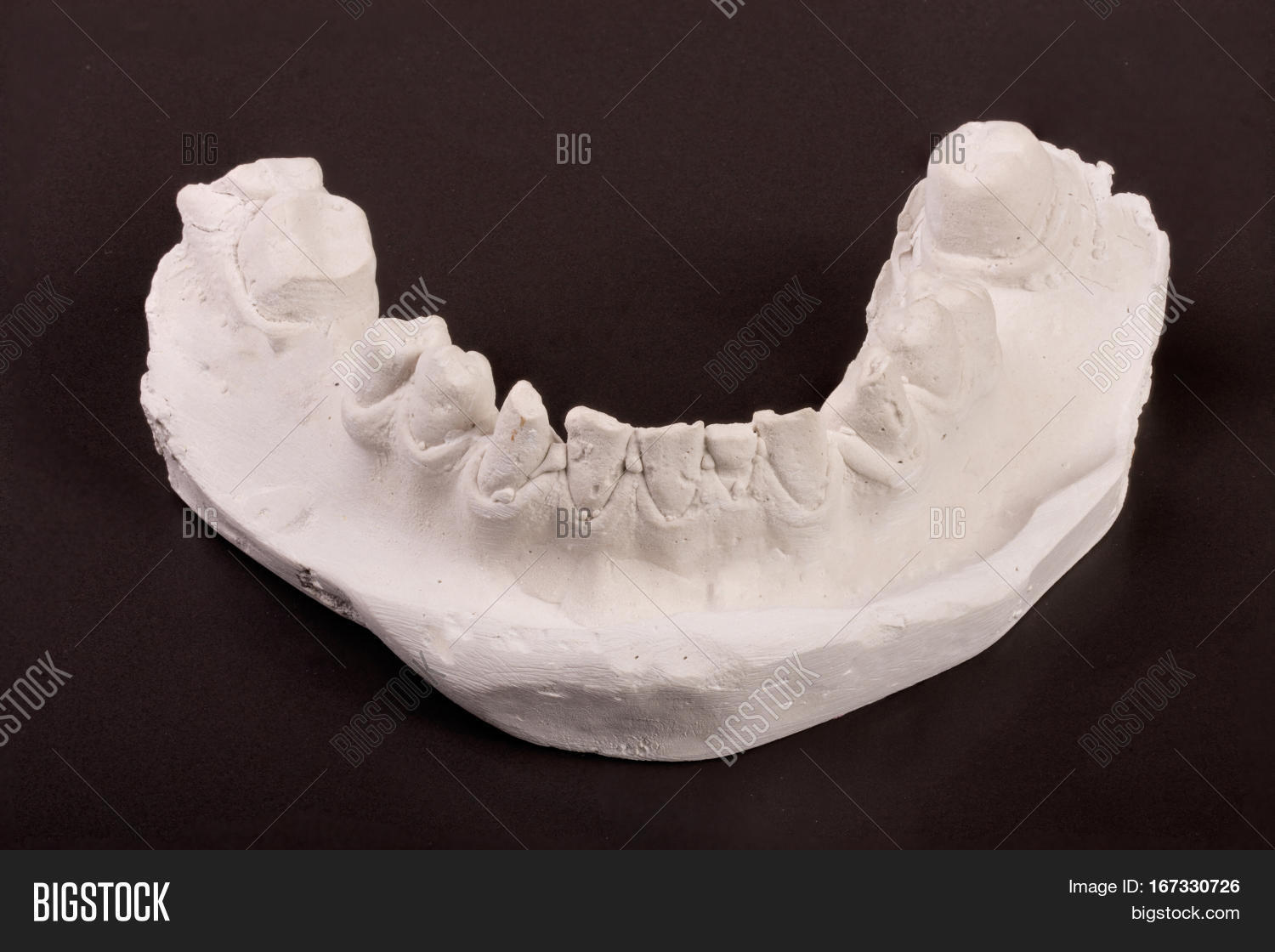 Plaster Cast Teeth Image & Photo (Free Trial) | Bigstock