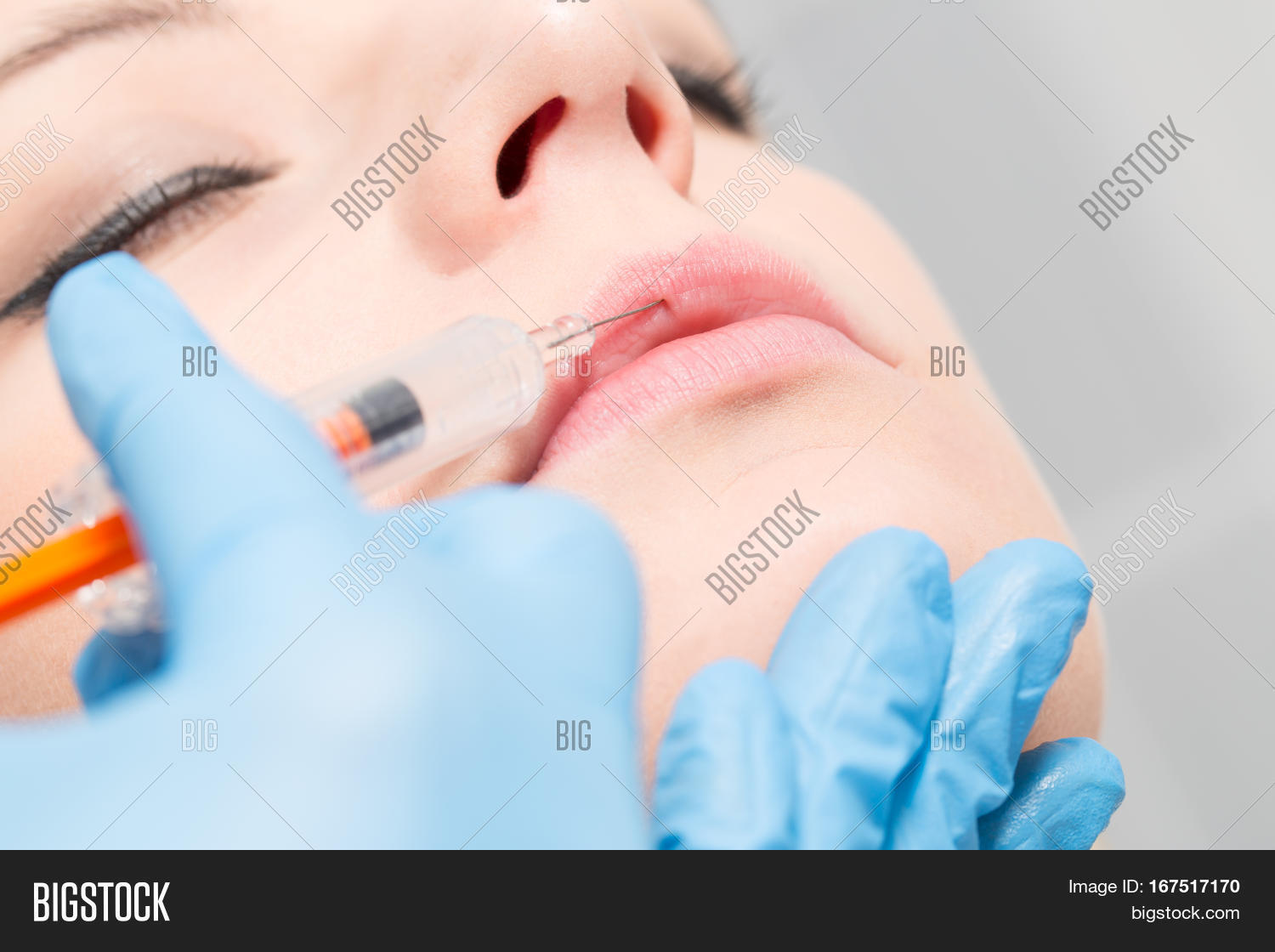 Botox Woman Fillers Image & Photo (Free Trial) | Bigstock