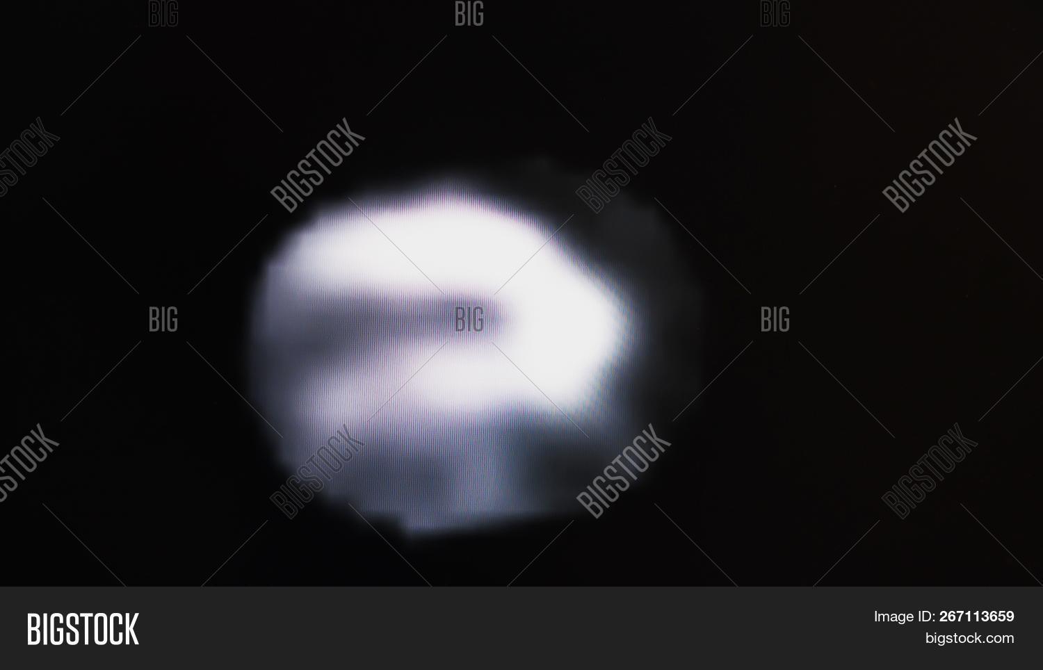 Mrt Heart Coronary Image & Photo (Free Trial) | Bigstock