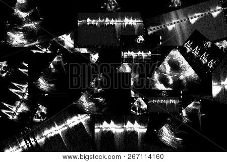 Cardiac Ultrasound Image & Photo (Free Trial) | Bigstock