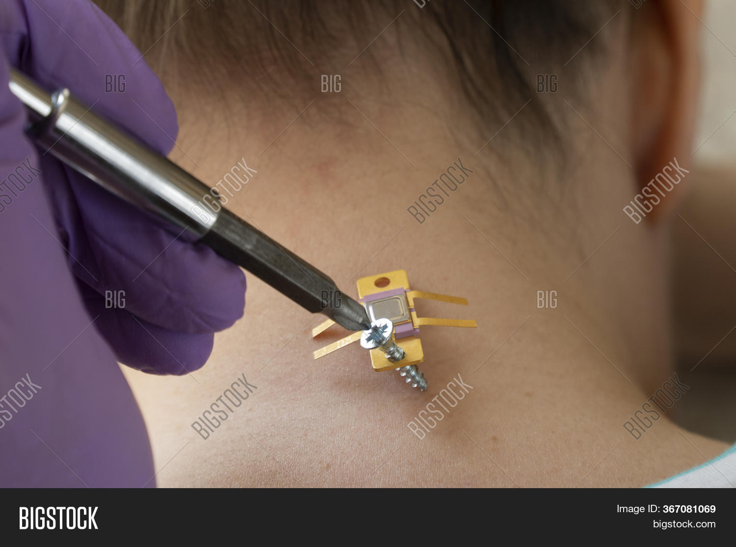 Implantation Chip Image & Photo (Free Trial) | Bigstock