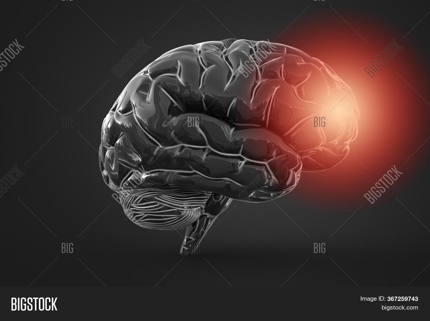 Brain Inflammation Image & Photo (Free Trial) | Bigstock