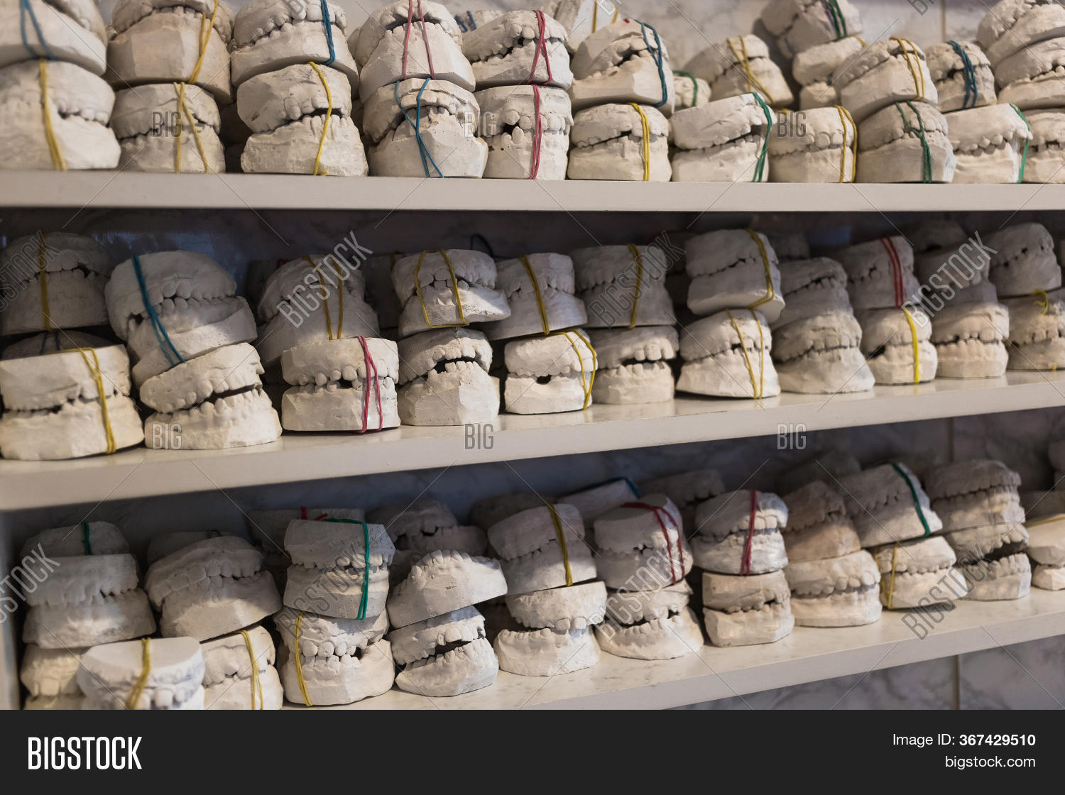 Dental Gypsum Models Image & Photo (Free Trial) | Bigstock