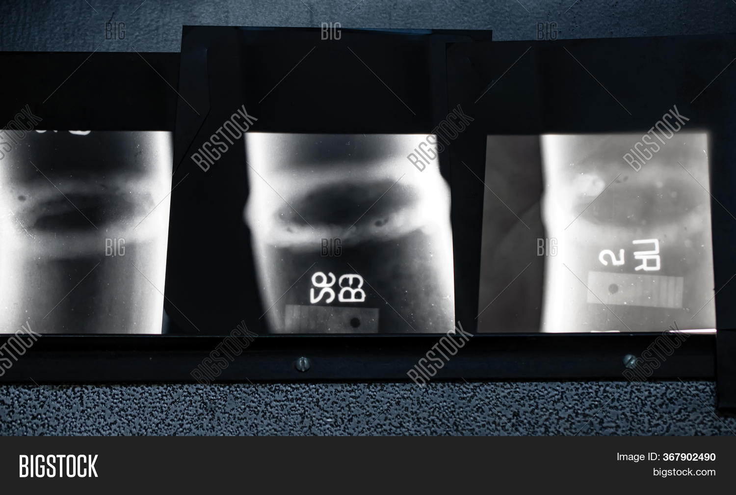 X-ray Image Welding Image & Photo (Free Trial) | Bigstock