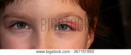 Barley Eye. Child Image & Photo (Free Trial) | Bigstock