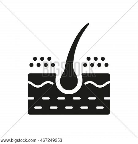 Hair Dandruff Vector & Photo (Free Trial) | Bigstock