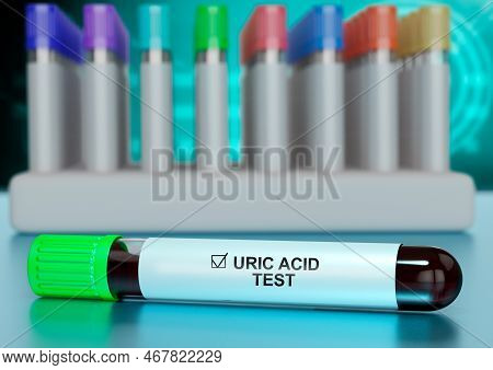 Human Blood Sample Image & Photo (Free Trial) | Bigstock