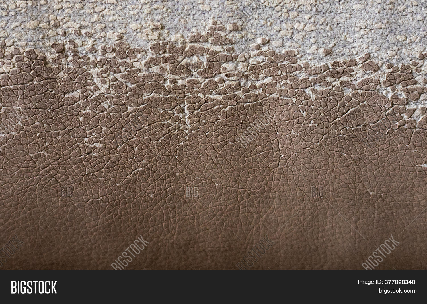 Texture Cracked Skin. Image & Photo (Free Trial) | Bigstock