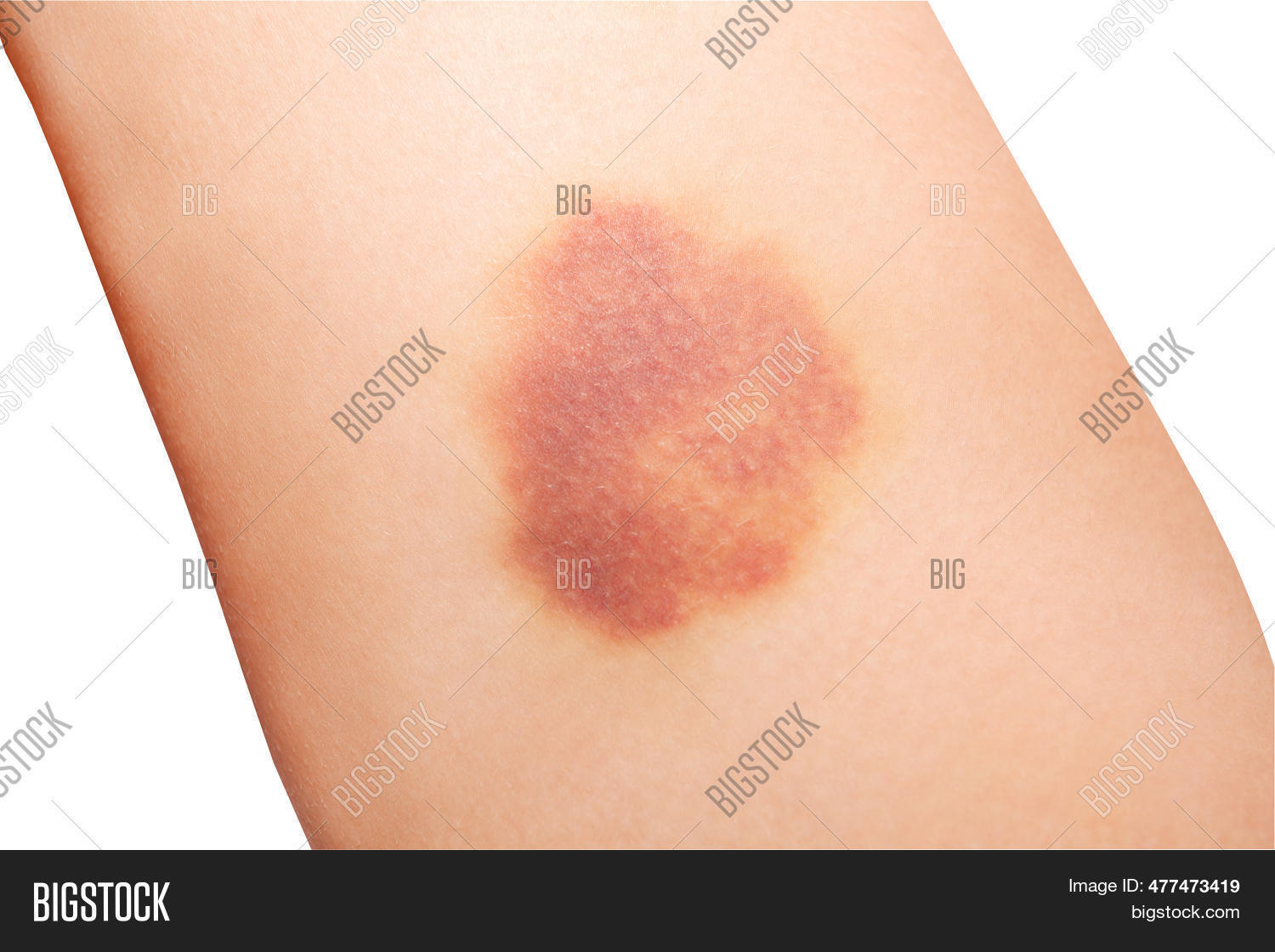 Female Leg Well- Image & Photo (Free Trial) | Bigstock