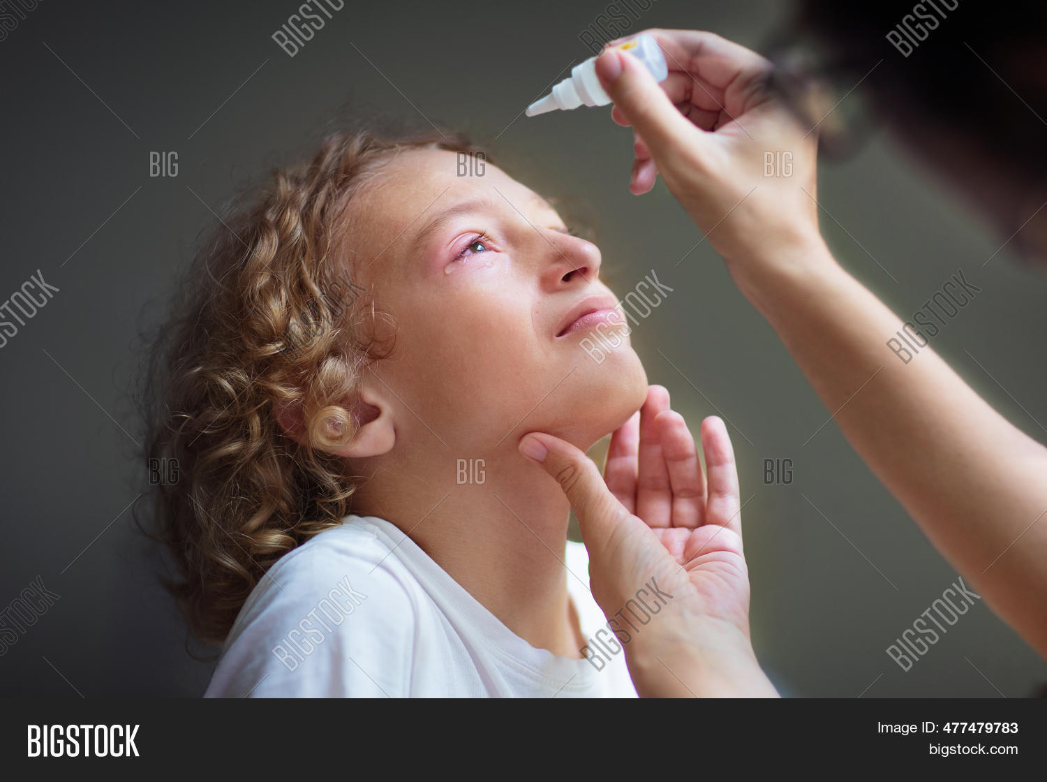 Child Swollen Pink Eye Image & Photo (Free Trial) | Bigstock