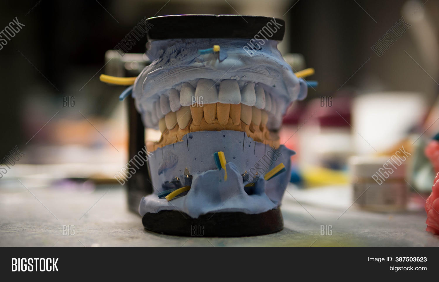 Orthodontic Cast Human Image & Photo (Free Trial) | Bigstock