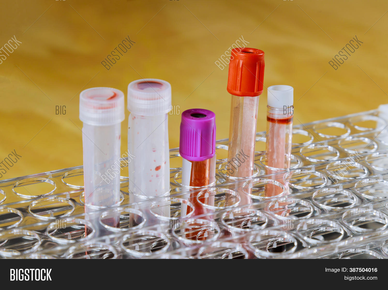 Blood Sample Image & Photo (Free Trial) | Bigstock