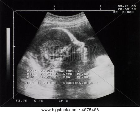 Baby Xray Image & Photo (Free Trial) | Bigstock
