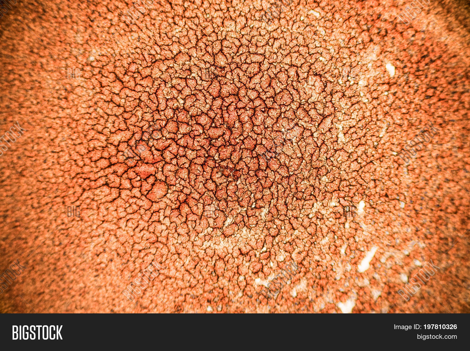Solidified Coagulated Image & Photo (Free Trial) | Bigstock