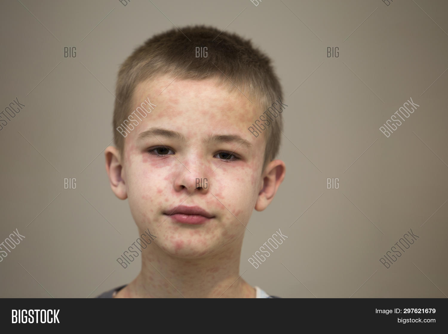 Portrait Sick Sad Boy Image & Photo (Free Trial) | Bigstock