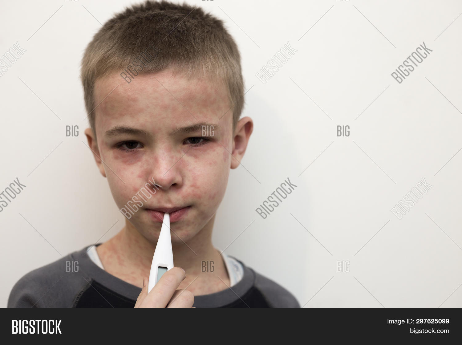 Portrait Sick Sad Boy Image & Photo (Free Trial) | Bigstock