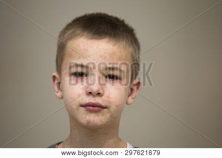 Portrait Sick Sad Boy Image & Photo (Free Trial) | Bigstock