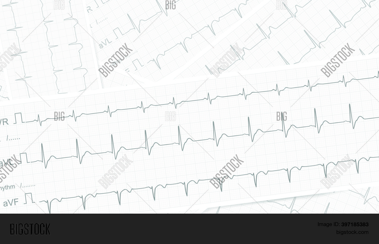 Ecg Vector Background Vector & Photo (Free Trial) | Bigstock