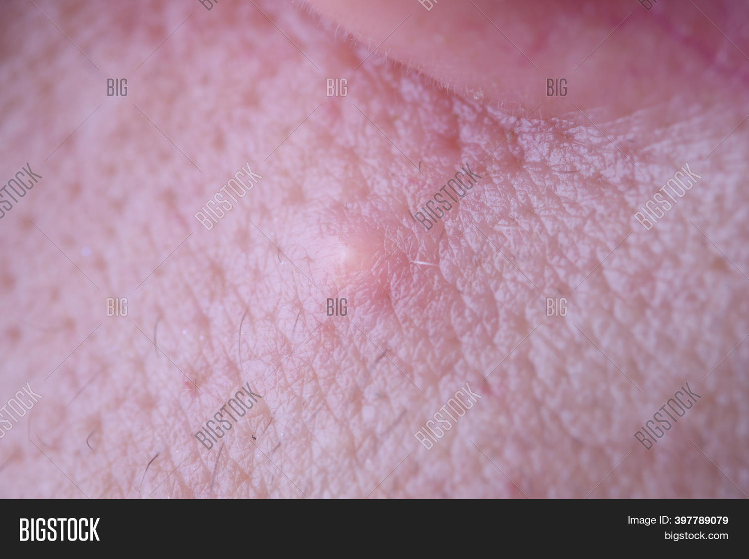 Inflammatory Diseases Image & Photo (Free Trial) | Bigstock