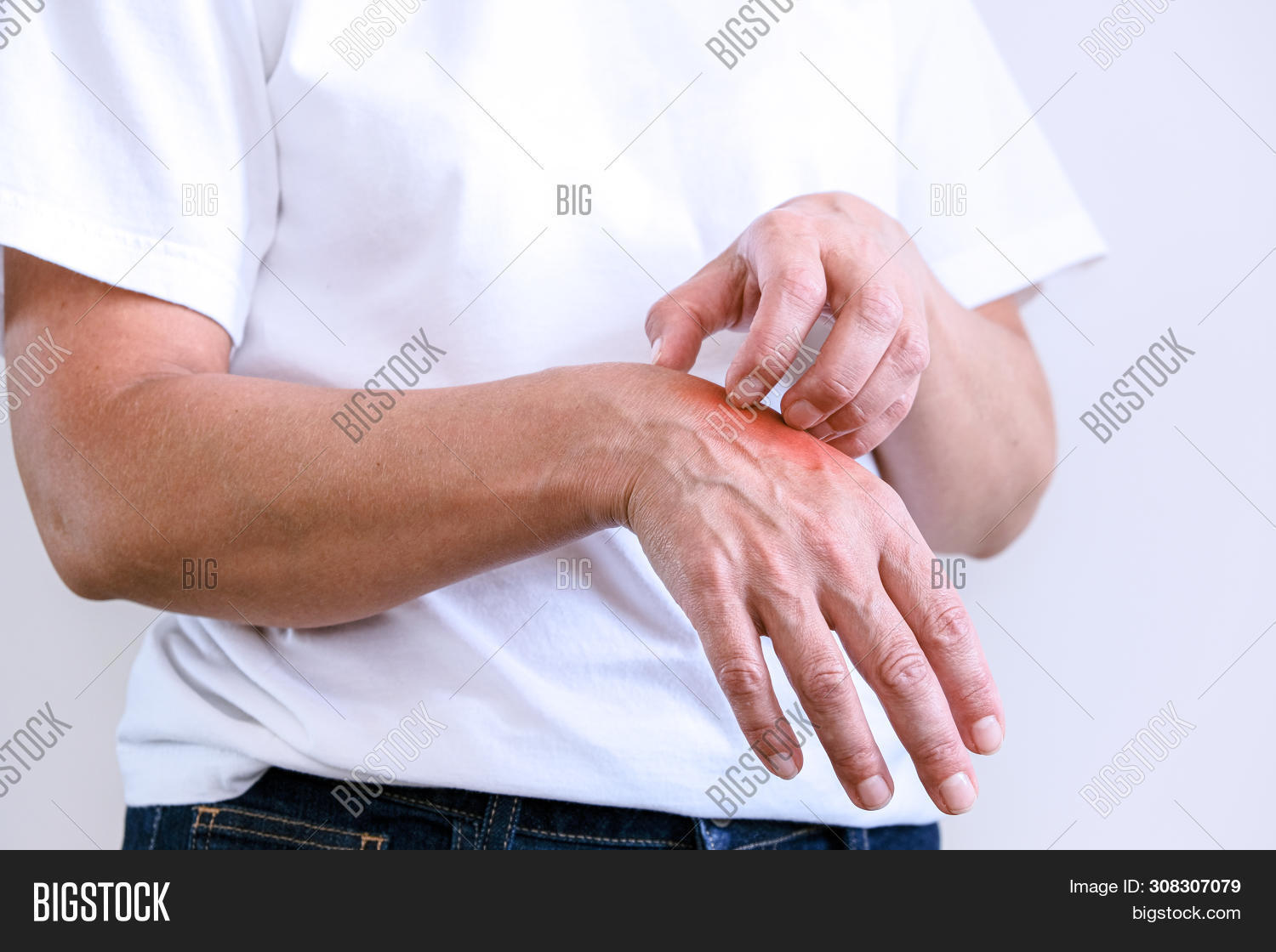 Woman Scratching Itch Image & Photo (Free Trial) | Bigstock
