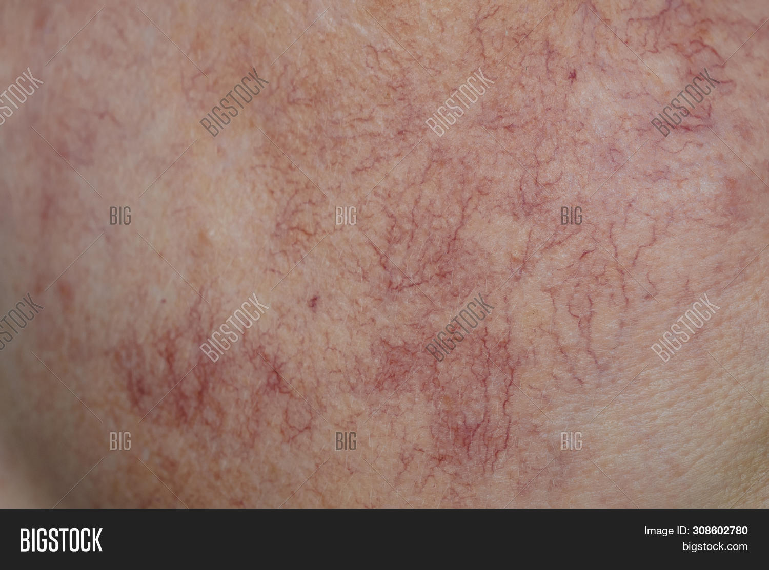 Close Skin Vascular Image & Photo (Free Trial) | Bigstock