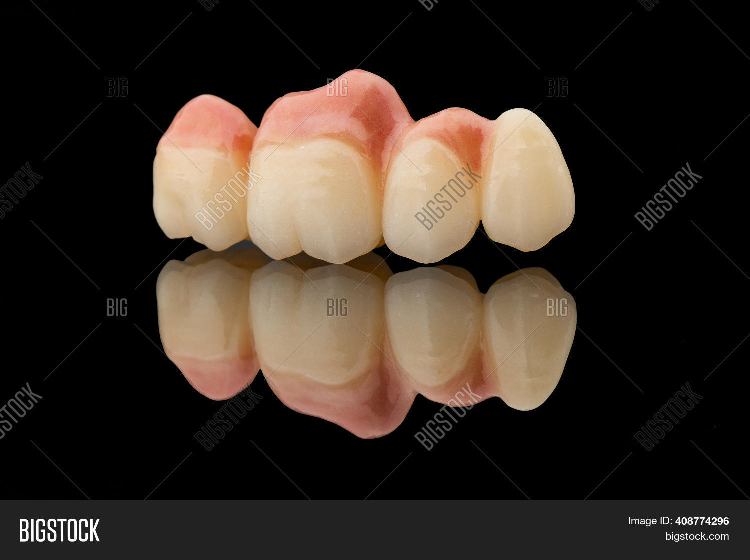 Dental Bridge 4 Teeth Image & Photo (Free Trial) | Bigstock