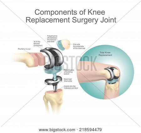 Components Knee Image & Photo (Free Trial) | Bigstock