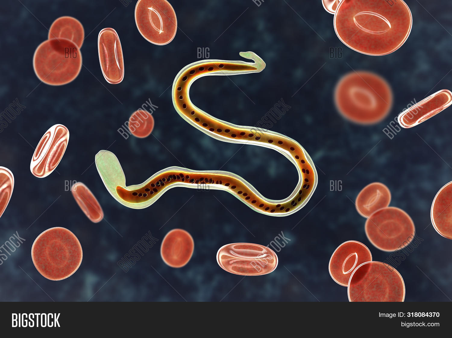 Wuchereria Bancrofti, Image & Photo (Free Trial) | Bigstock