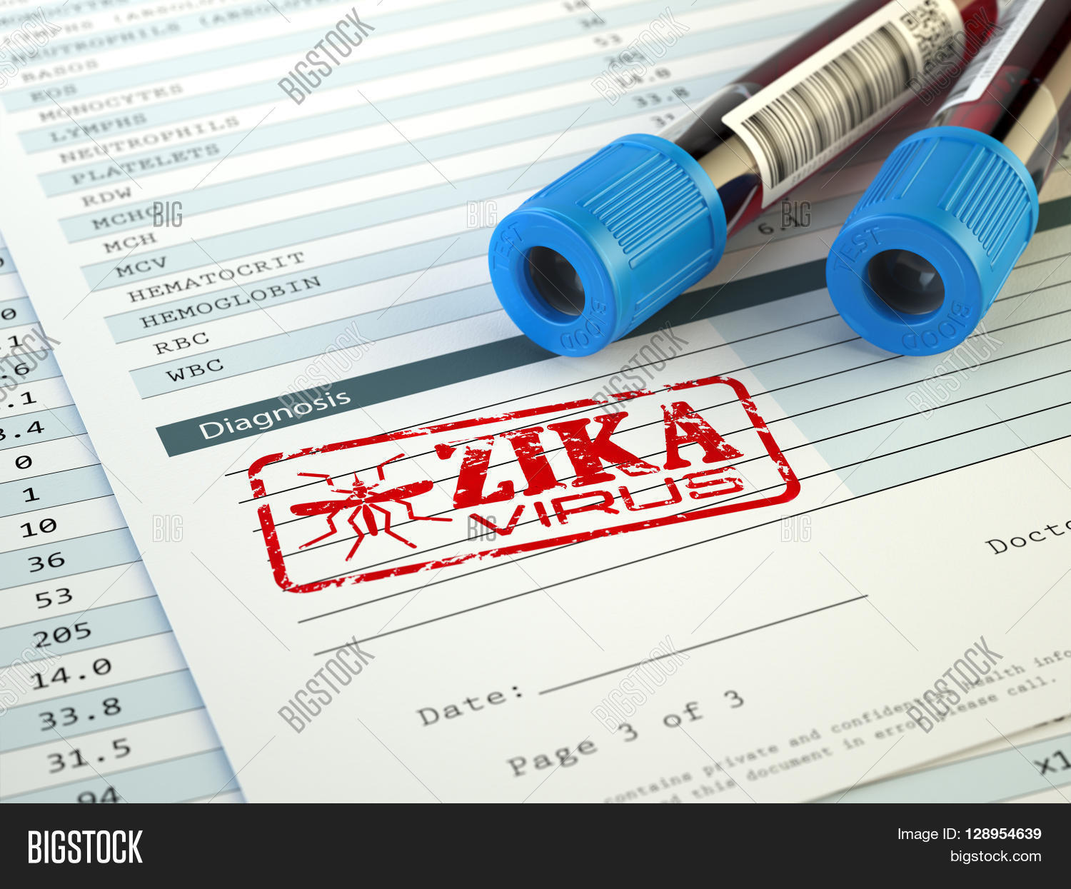 Zika Virus Diagnosis. Image & Photo (Free Trial) | Bigstock