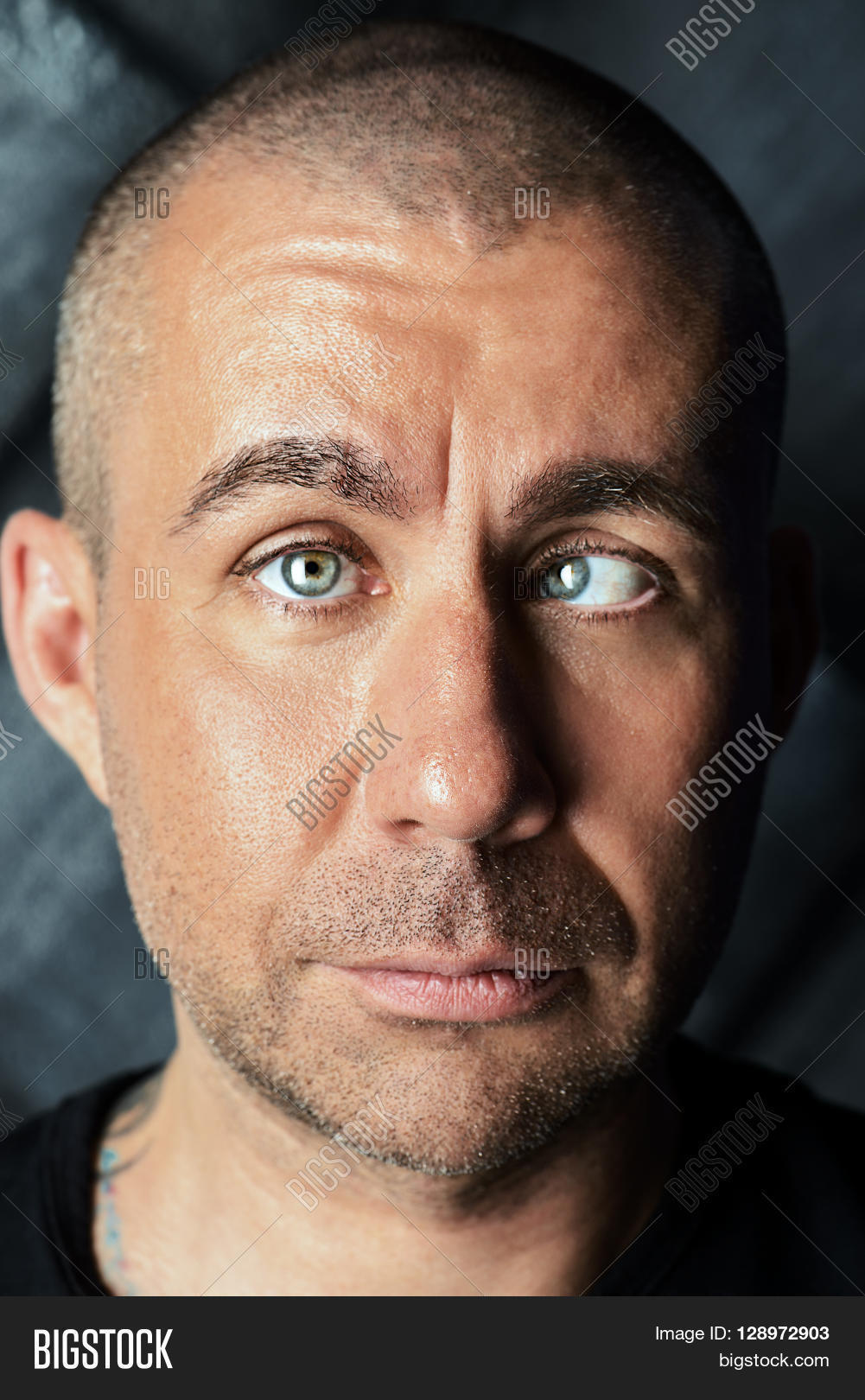 Man Strabismus. Image & Photo (Free Trial) | Bigstock