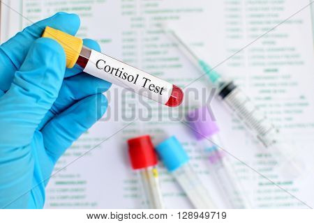 Test Tube Blood Sample Image & Photo (Free Trial) | Bigstock