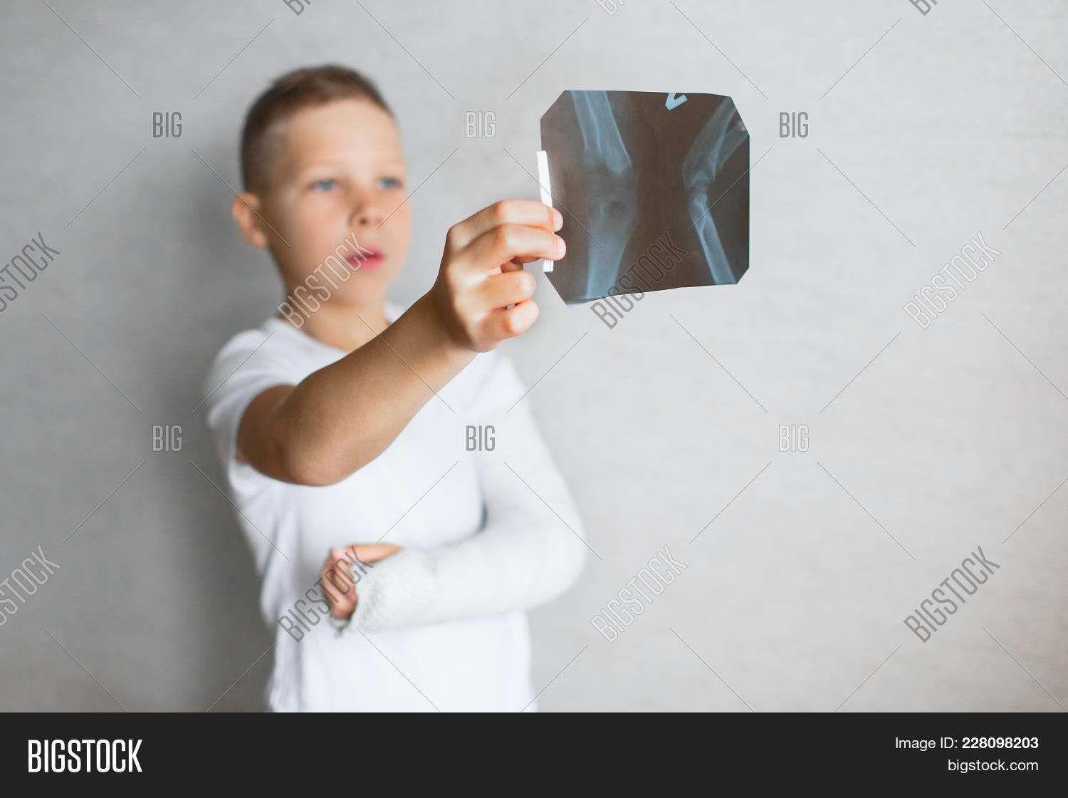 Boy Broken Hand Looks Image & Photo (Free Trial) | Bigstock