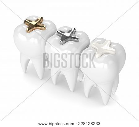 3D Render Teeth Image & Photo (Free Trial) | Bigstock