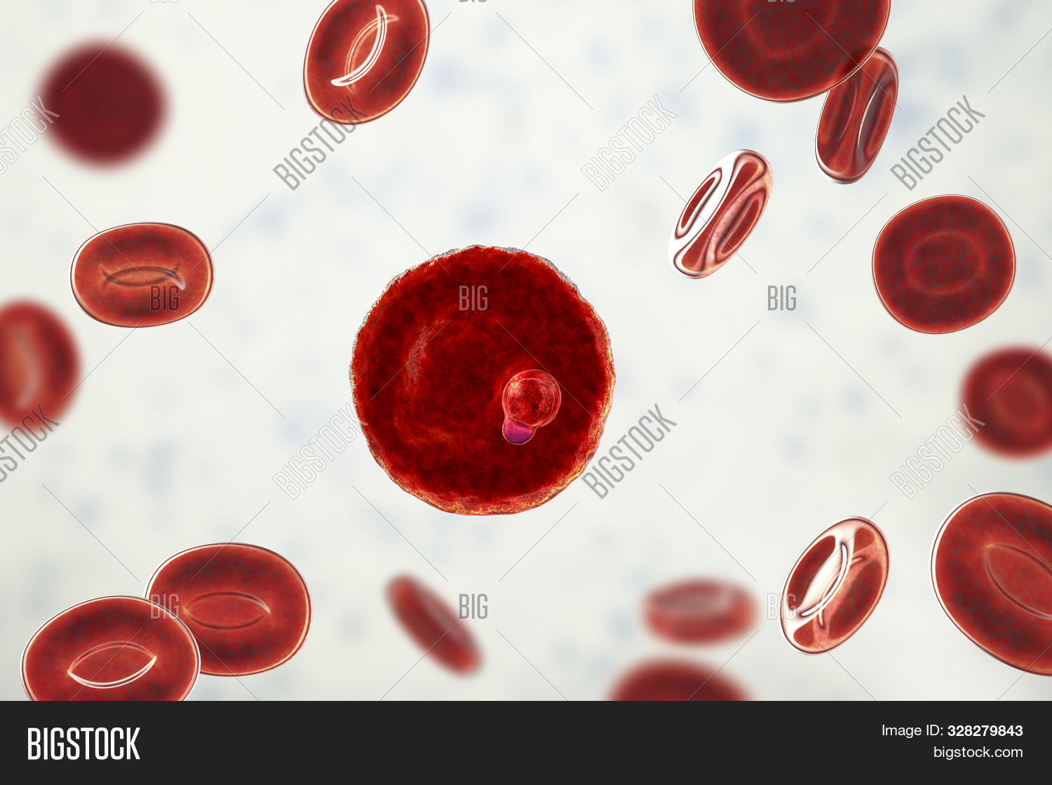Malaria-infected Red Image & Photo (Free Trial) | Bigstock