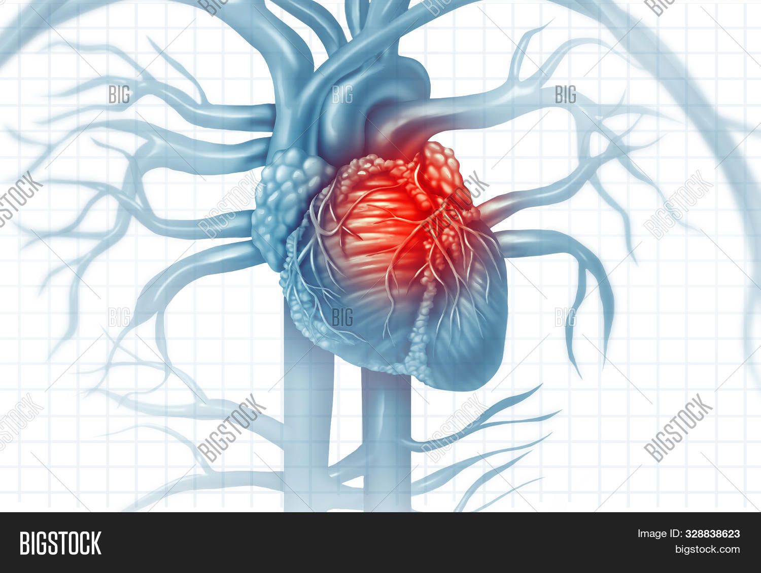 Cardiovascular Disease Image & Photo (Free Trial) | Bigstock