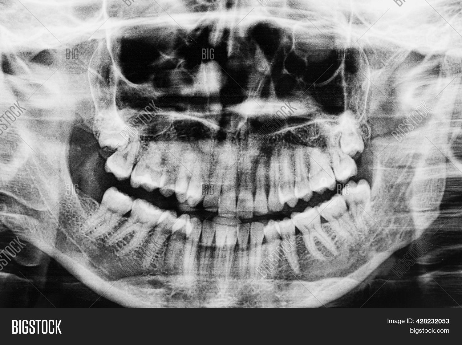 Different Types Wisdom Image & Photo (Free Trial) | Bigstock