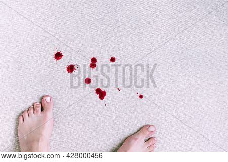 Drops Blood On Carpet Image & Photo (Free Trial) | Bigstock